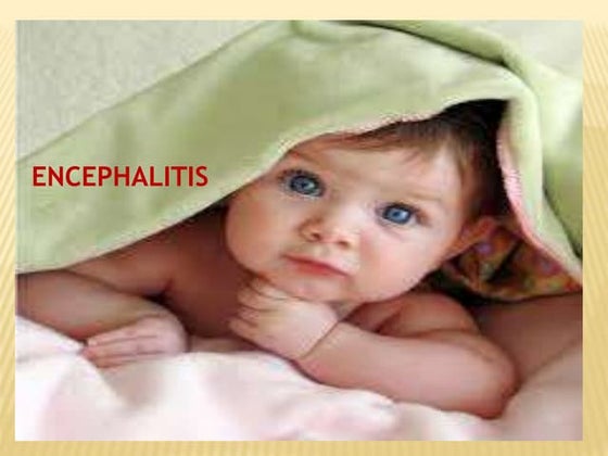 Encephalitis | PPTX