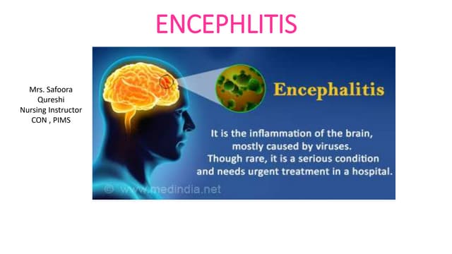 Encephalitis | PPTX