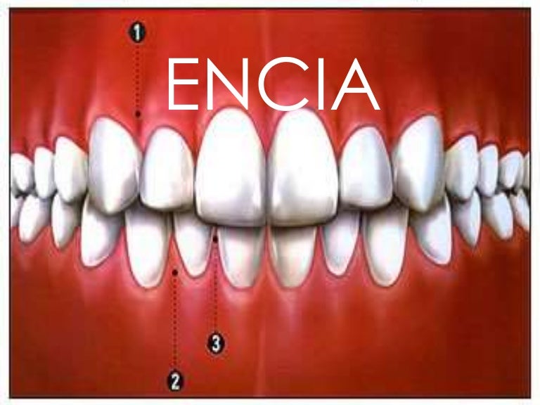 Encias