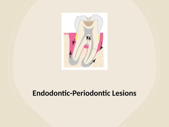 Endodontics periodontal lesions | PPTX | Dental Health | Diseases and ...