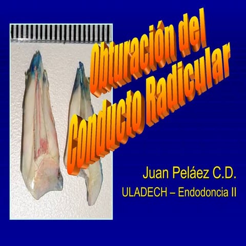 Endo01 12 Obturacion Del Conducto Radicular | PPT