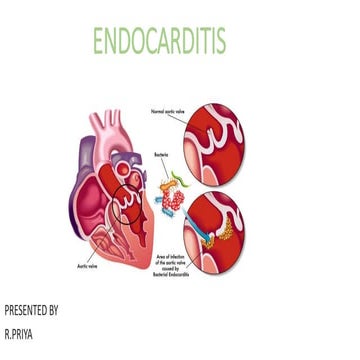 endocarditis-190810200948.pptx