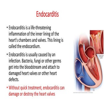 Endocarditis (1).pptx