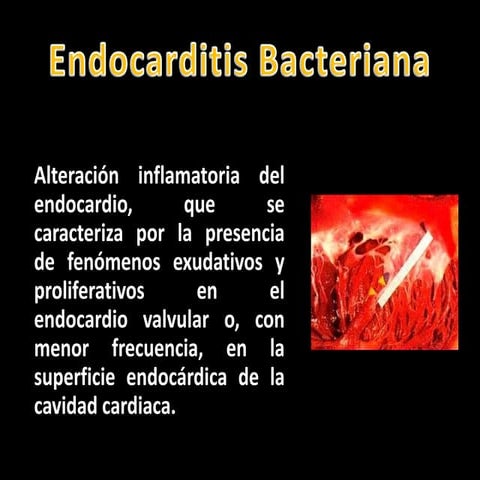 Endocarditis Bacteriana | PPT