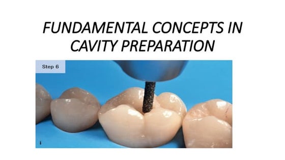 Class II cavity preparation | PPTX | Dental Health | Diseases and ...