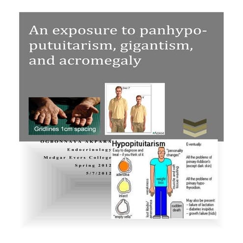 Gigantism | PDF