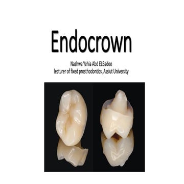 Endo crown | PPTX