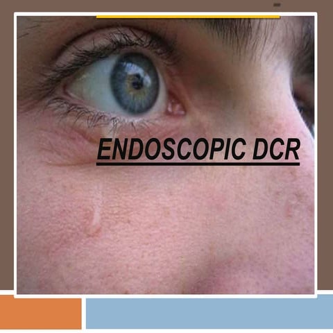 Endoscopic DCR | PPTX