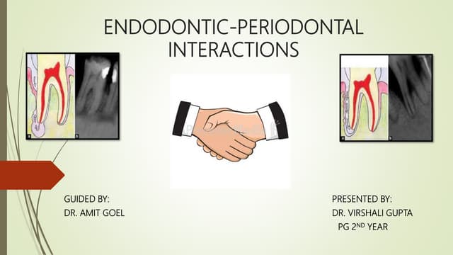 Endodontics periodontal lesions | PPTX | Dental Health | Diseases and ...
