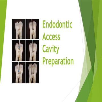 Endodontic Access Opening and Canal Location | PDF