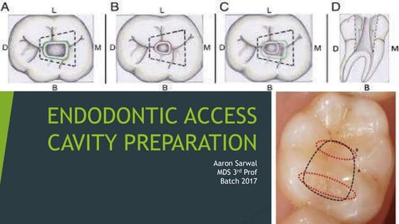 The Permanent Maxillary First Molar | PPT
