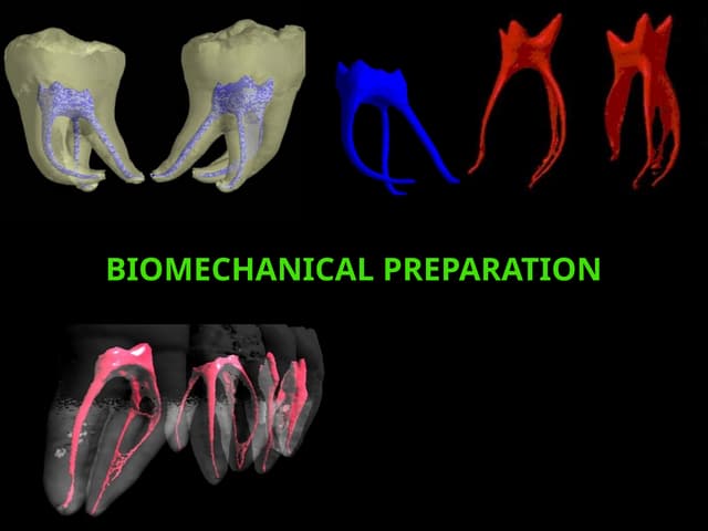 Everything you need to know about endo files | PPTX