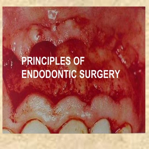 Basic principles of Endodontic Surgery . | PPTX
