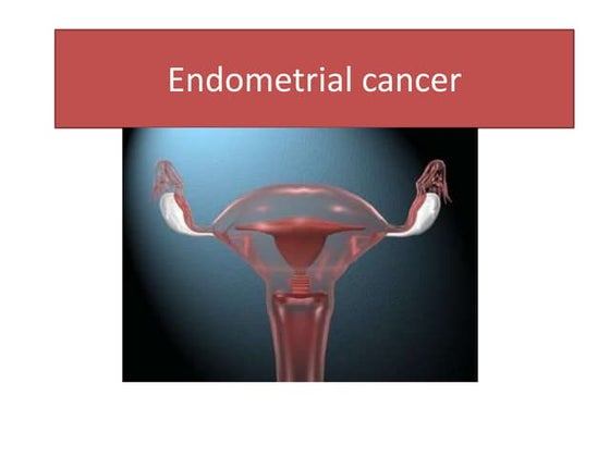 Case Study: Endometrial Cancer | PPT