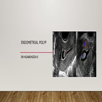 ENDOMETRIAL POLYP and ADENOMYOSIS GAKO.pptx