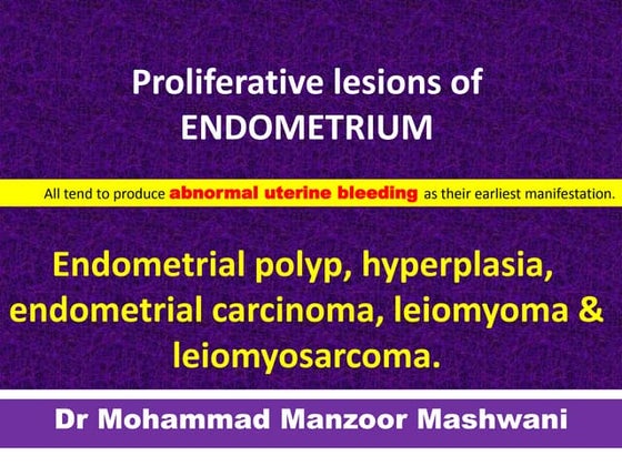 Endometrial polyps | PPT