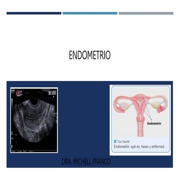Endometrio imagenologia .pptx........... | PPTX