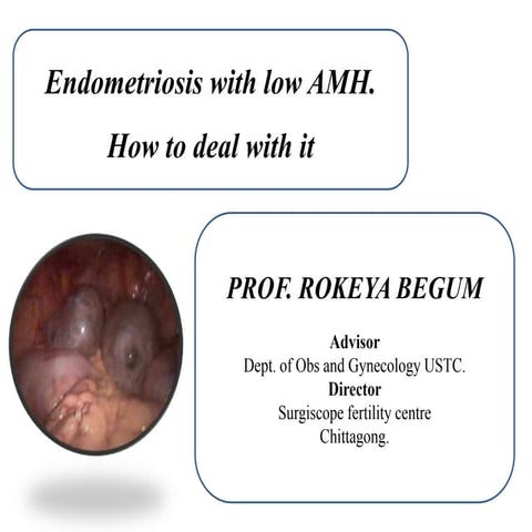 Endometriosis | PPT
