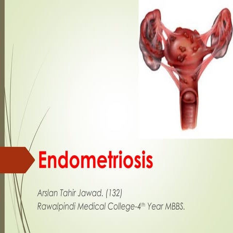 Endometriosis | PPT