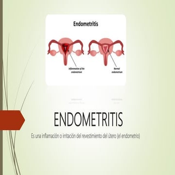 Endometritis | PPTX