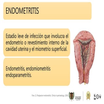Sepsis puerperal, endometritis y corioamnionitis-1.pptx