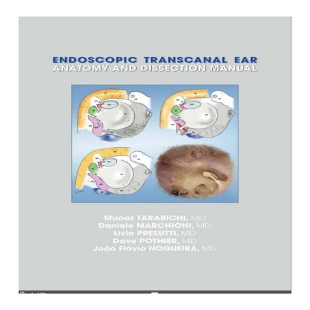 Endoscopic ear anatomy & Dissection | PDF