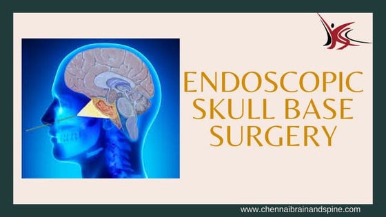 Endoscopic Brain Surgery - Brain and Spine Surgery.pptx