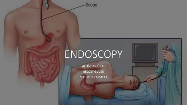 Endoscopy Ppt 3649