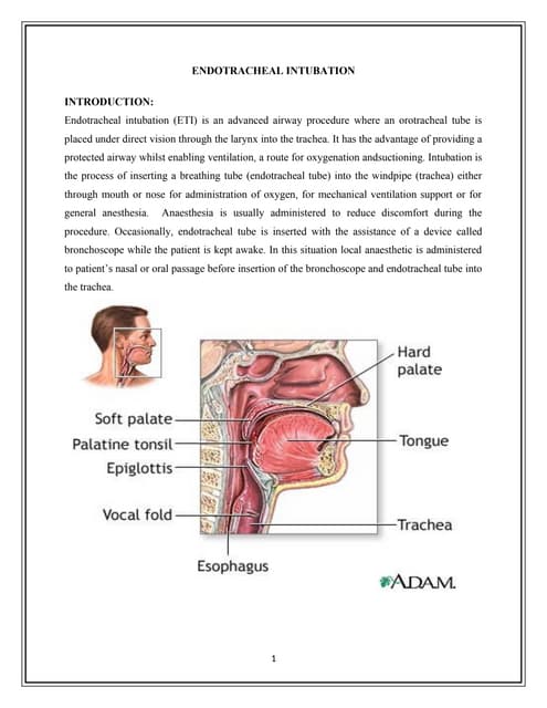 Intubation Procedure Note Full Article: Problems Related To
