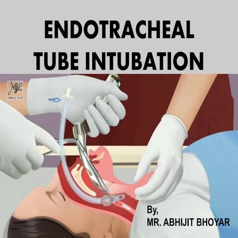 Endotracheal intubation | PPTX