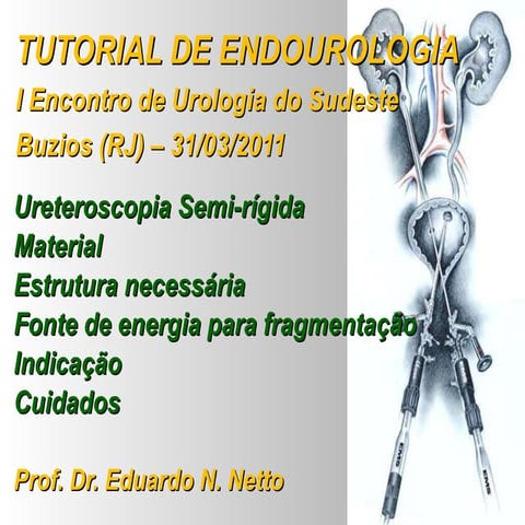 Endourologia - Ureteroscopia Semi-rígida | PPT