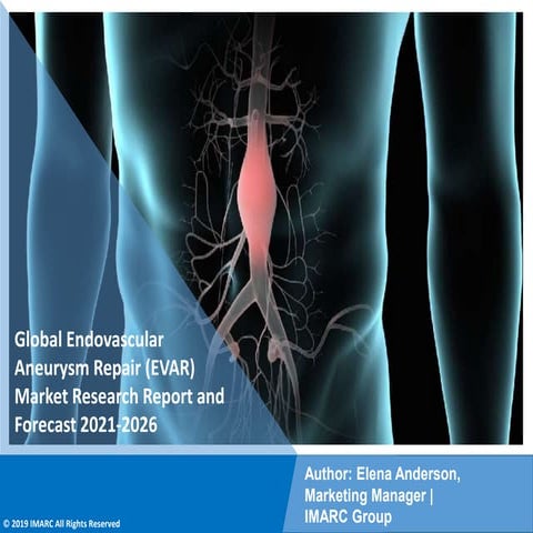 Endovascular Aneurysm Repair (EVAR) Market PPT by Product Type ...