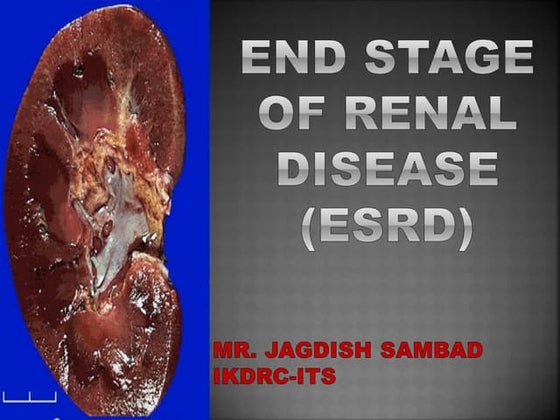 Chronic Kidney Disease (CKD) | PPT