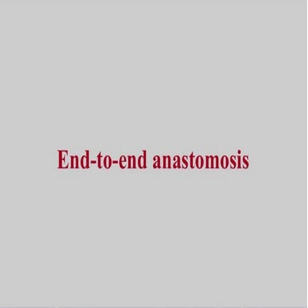 Hypospadias 3: MAGPI & snod grass (TIP) step by step operative urology ...