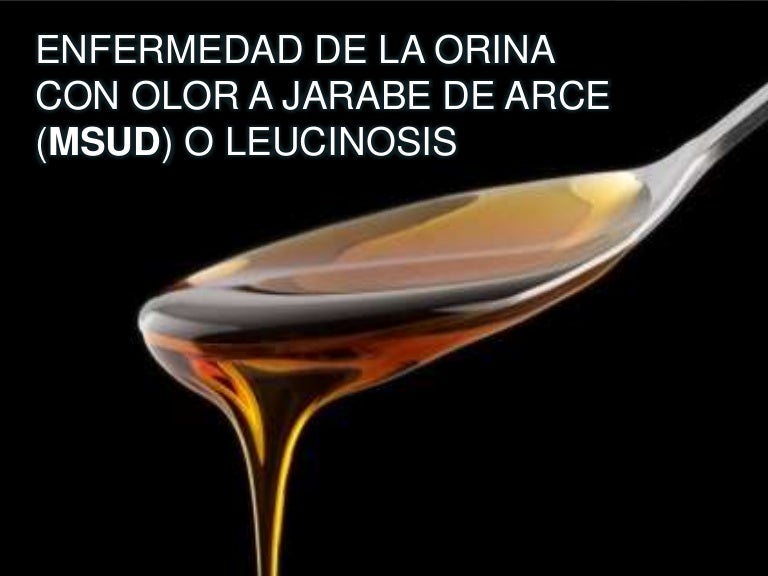 Enfermedad de la orina con olor a Jarabe de Arce(MSUD) o Leucinosis