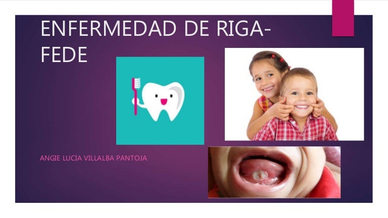 Enfermedad de riga fede