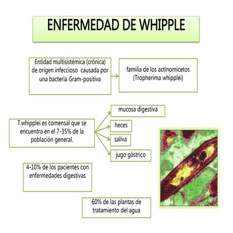 Enfermedad de whipple | PPTX