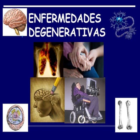 Enfermedades cronico degenerativas.