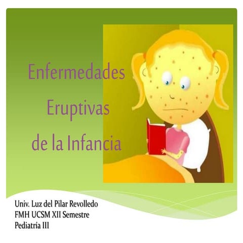 ENFERMEDADES ERUPTIVAS DE LA INFANCIA | PPTX