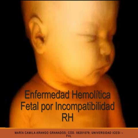 Enfermedad hemolítica fetal por incompatibilidad rh | PPTX
