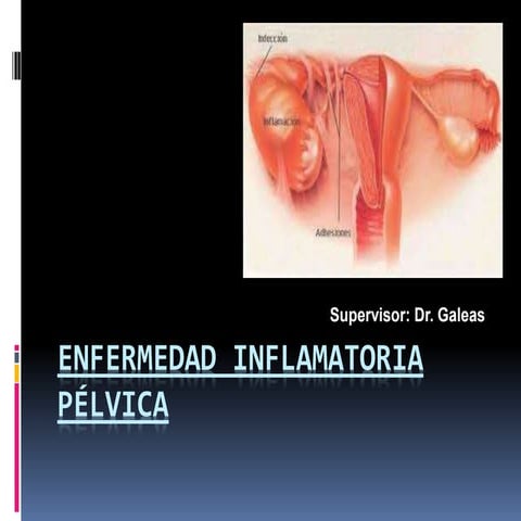 ENFERMEDAD INFLAMATORIA PÉLVICA.pptx