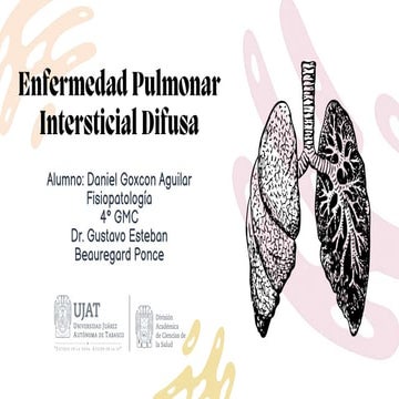 Enfermedad Pulmonar Intersticial Difusa EPID - copia.pptx