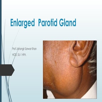 enlarged parotid swelling diagnosis and management.ppt