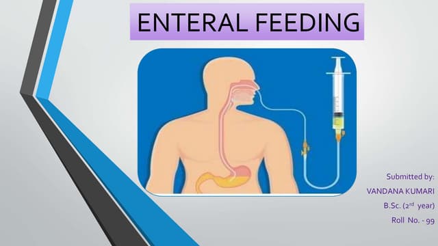 Nasogastric tube feeding | PPTX