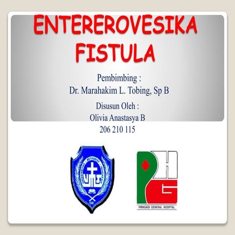 Entererovesika fistula | PPTX