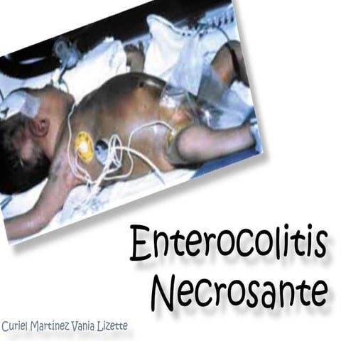 ENTEROCOLITIS NECROSANTE | PPTX