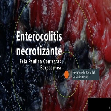 Enterocolitis necrotizante | PPTX