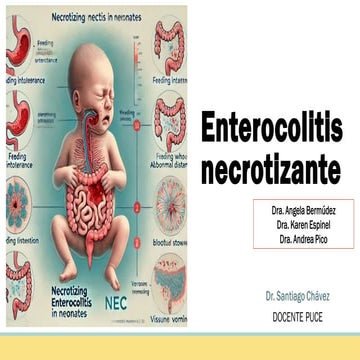 Enterocolitis necrotizante del recién nacido | PDF