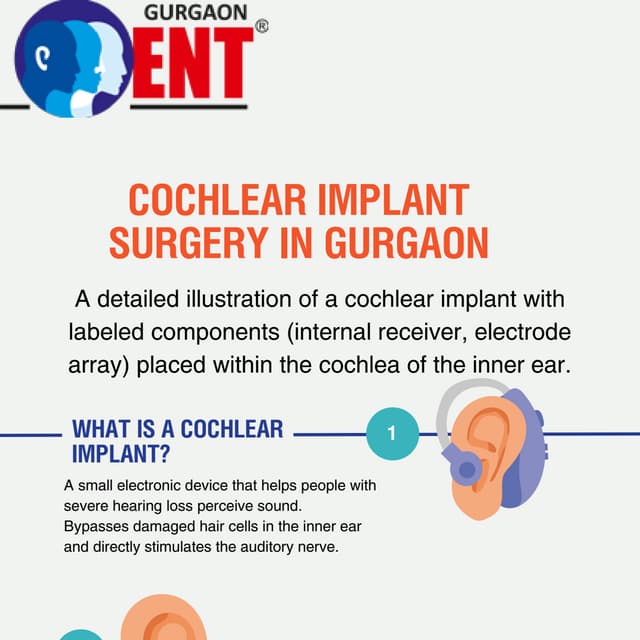 Cochlear Implant Surgery in Gurgaon (ENT INFOGRAPHY) | PDF | Ear, Nose ...