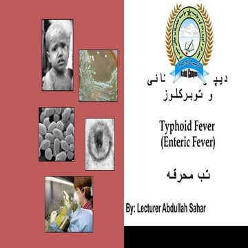 Entric Fever.pptx